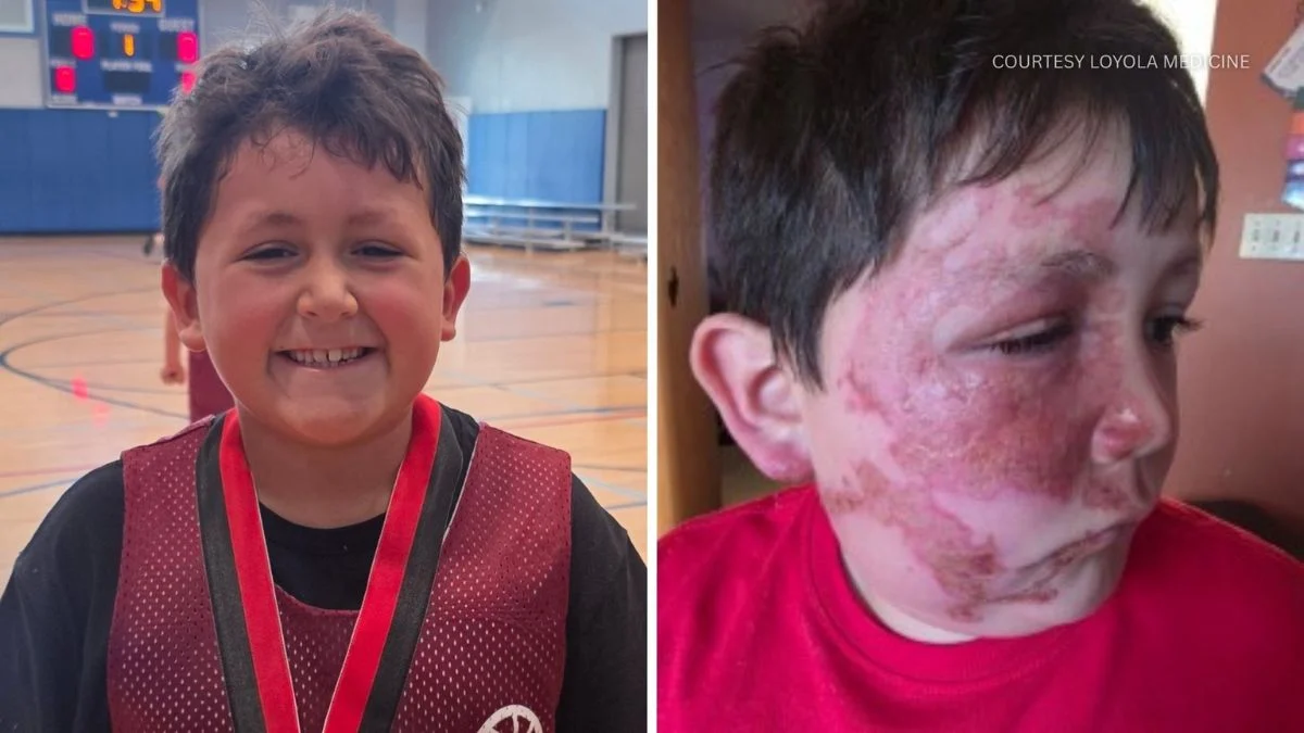 TikTok Microwave Trend Leaves 9-Year-Old Illinois Boy With Severe ...